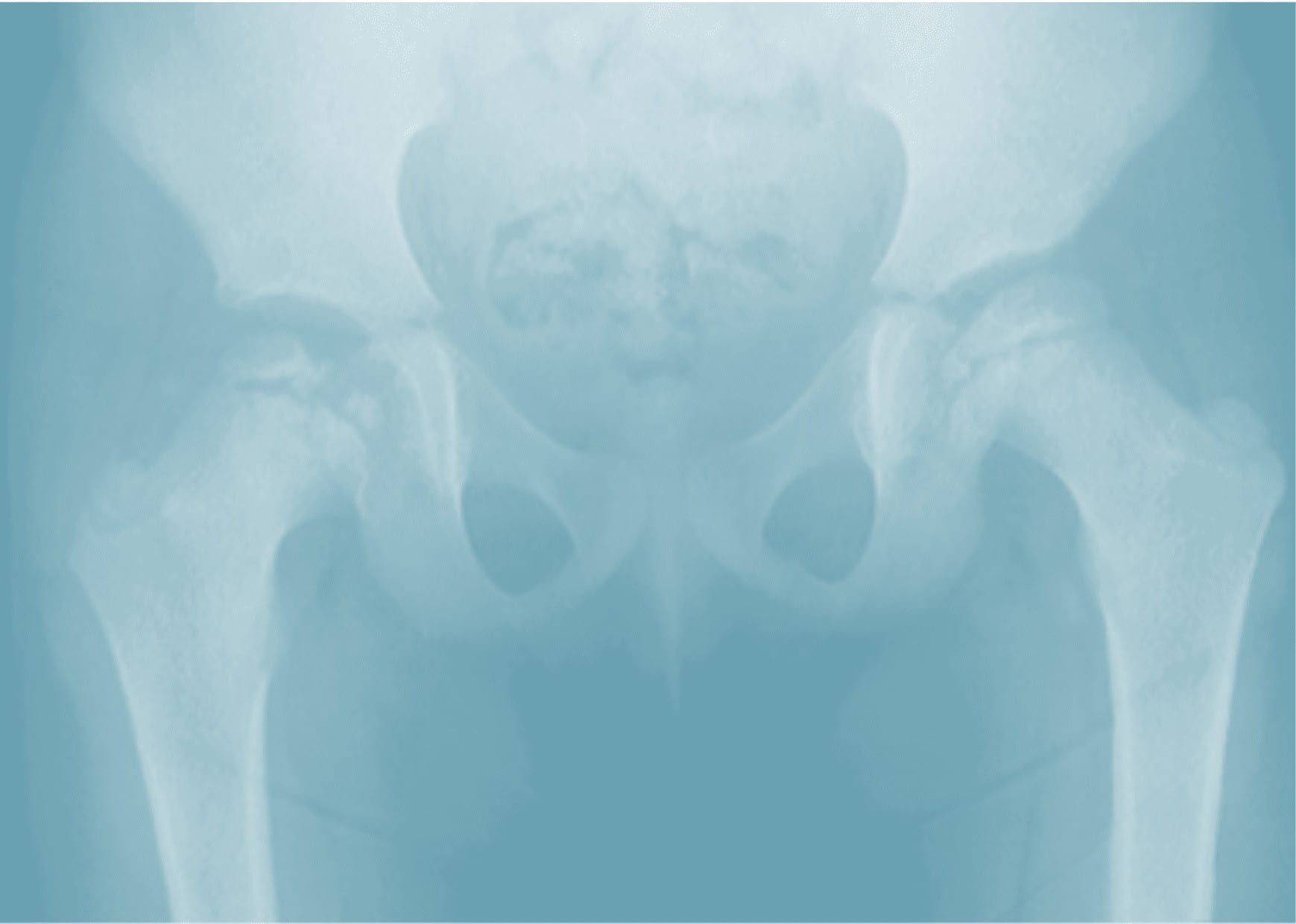Annual Shriners Guest Lecture: Paediatric Hip - Medical School ...