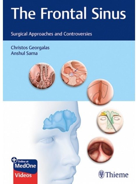New book on Frontal Sinus - Medical School - University of Nicosia